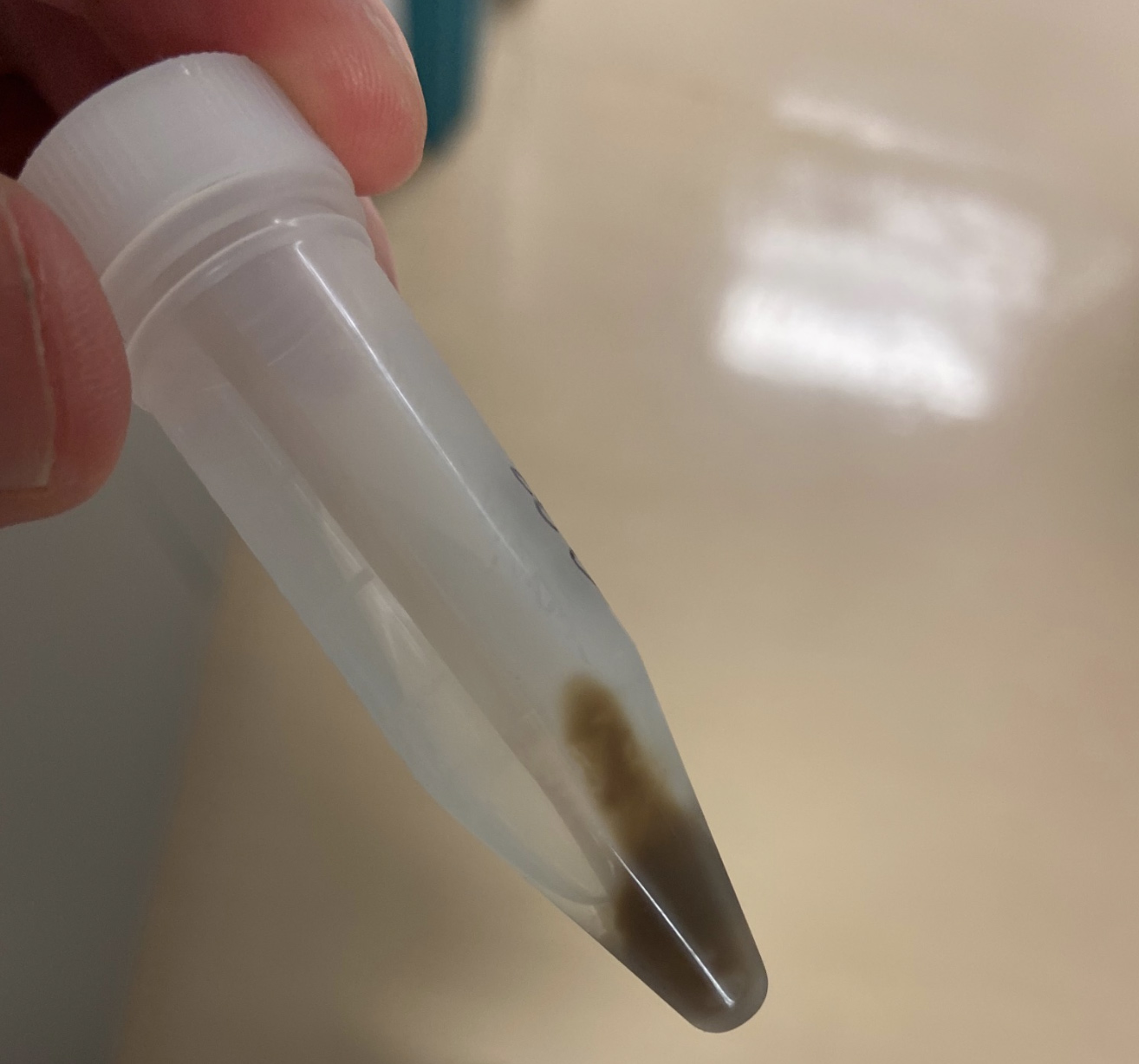 Using poop to identify individual killer whales | Raincoast